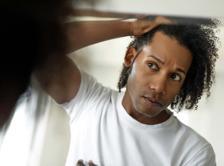 Hair Loss - Alopecia | Specialists in Hair Loss | Skin Health Forever